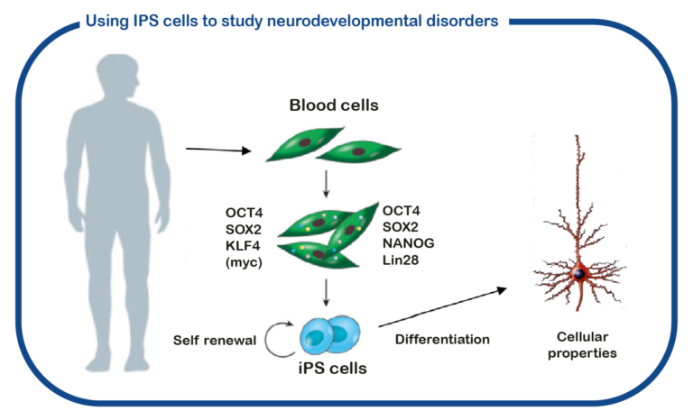 Tubereuze sclerose complex (TSC) – Encore