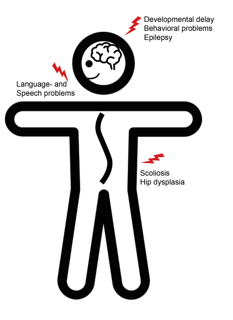 SYNGAP1 Syndroom – Encore