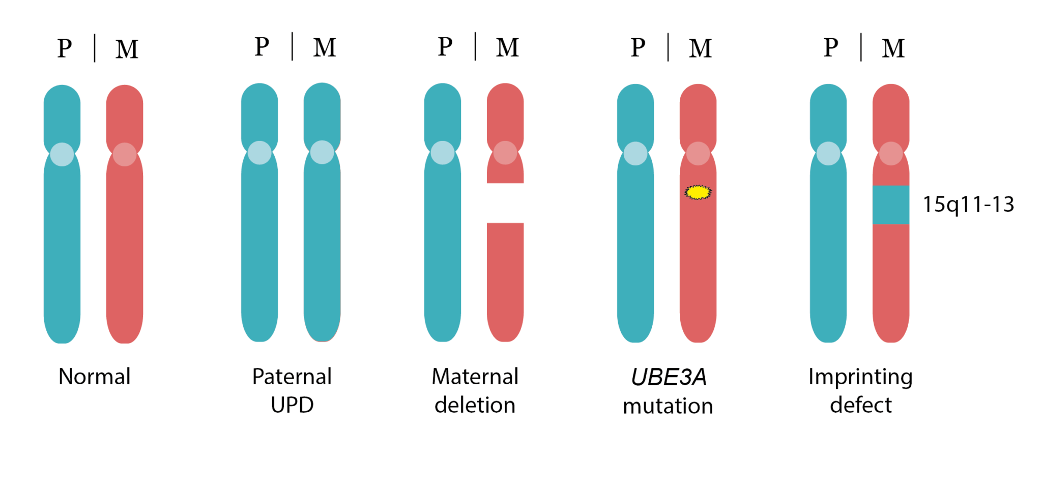 Angelman Syndroom – Encore